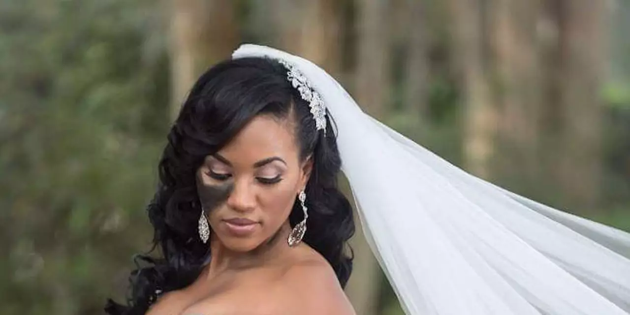 Esta mujer se negó a cubrir su llamativa marca de nacimiento facial el día de su boda
