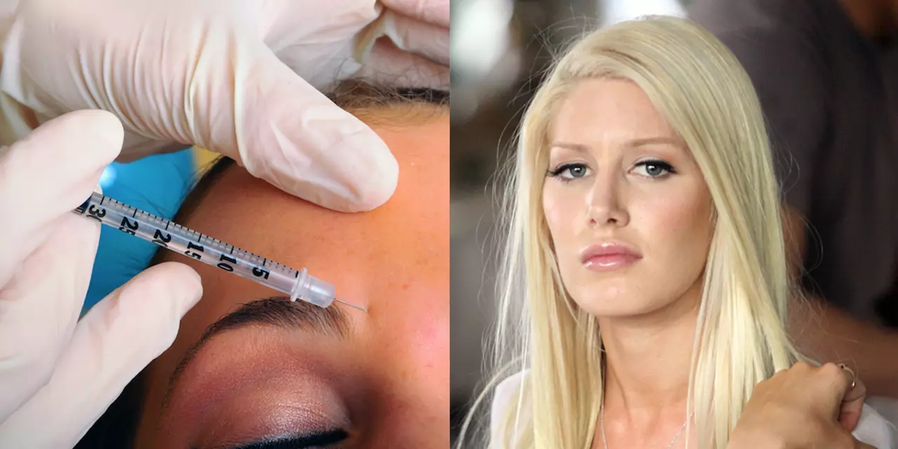 Izao indrindra no mitranga amin'ny vatanao rehefa mahazo Botox ianao